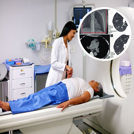 NCCT Lower Chest & Upper Abdomen | Test Price in Delhi | Ganesh Diagnostic