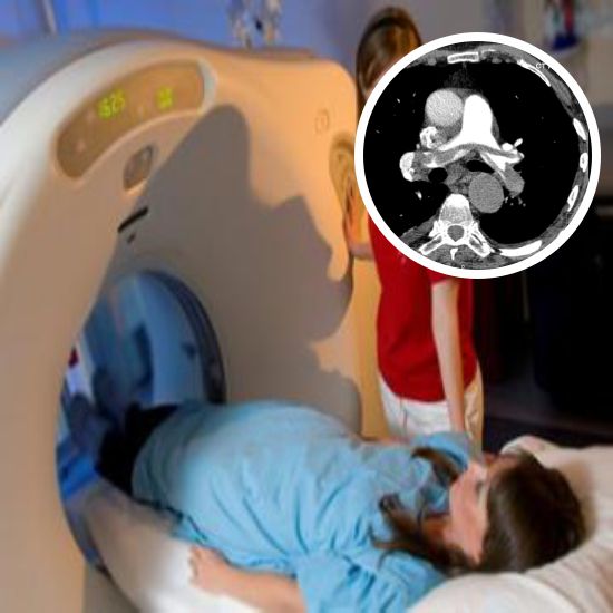 CT Pulmonary Angiography | Test Price in Delhi | Ganesh Diagnostics