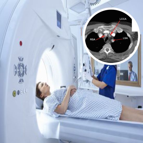 CT Angiography Arch Of Aorta | Test Price in Delhi | Ganesh Diagnostic