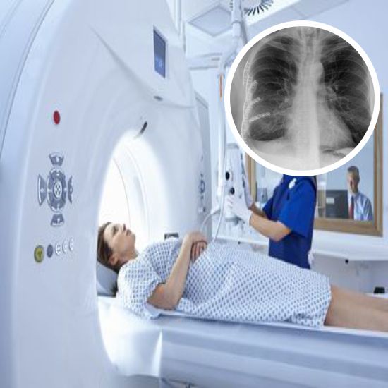 Thorax Ct Scan Chest CT Scan Melbourne Radiology