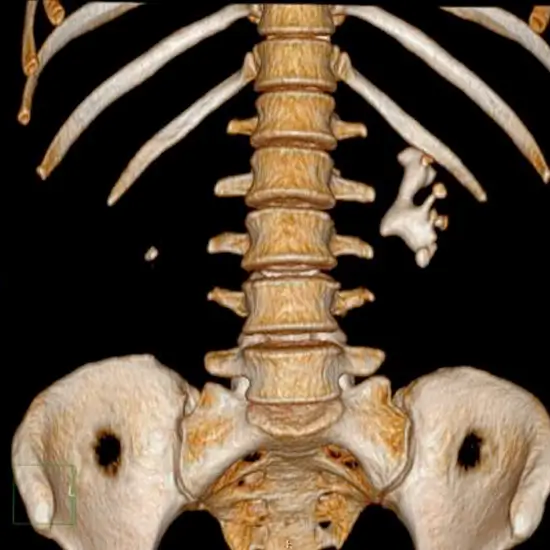 3D CT KUB | Test Price in Delhi | Ganesh Diagnostic