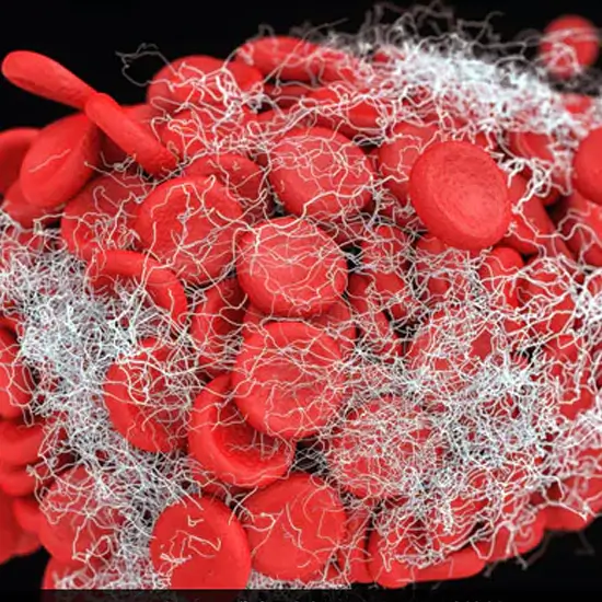 Tissue For Culture And Sensitivity | Test Price In Delhi, India ...