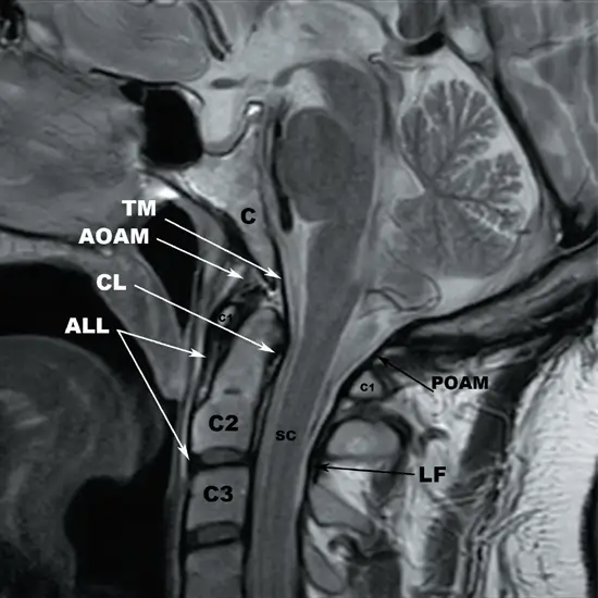 MRI CV Junction | Test Price in Delhi | Ganesh Diagnostic