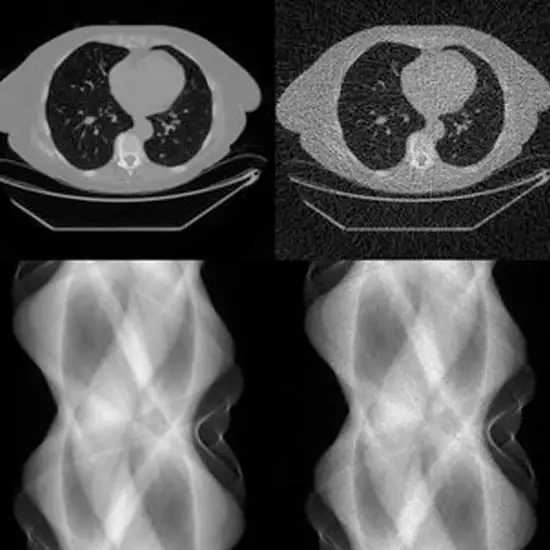 CT Sinogram | Test Price in Delhi | Ganesh Diagnostic