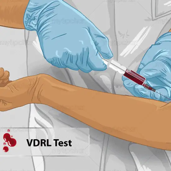 VDRL Titre | Test Price In Delhi | Cost Near Me, India | Ganesh Diagnostic