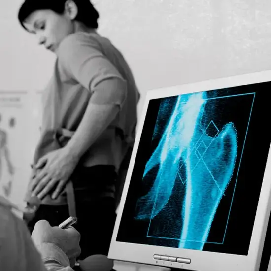 Bone Densitometry (DEXA 3) Three Sites Price Near Me, Delhi India ...