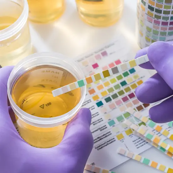 Book Urine Culture and Sensitivity | Test Price In Delhi, India ...