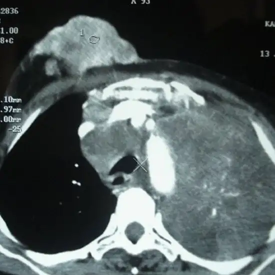 CECT Lower Chest | Test Price in Delhi | Ganesh Diagnostics