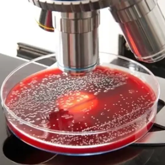 Blood Culture and Sensitivity Cost in Delhi Test Price Near Me | GDIC