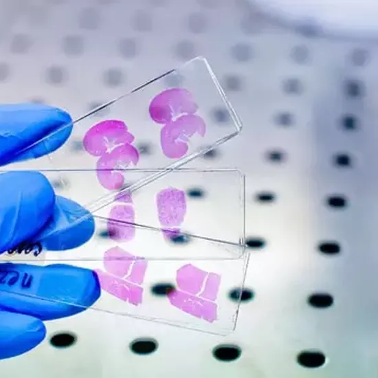 Immunohistochemistry MMR Test Near You in Delhi | Book Test at Low Price