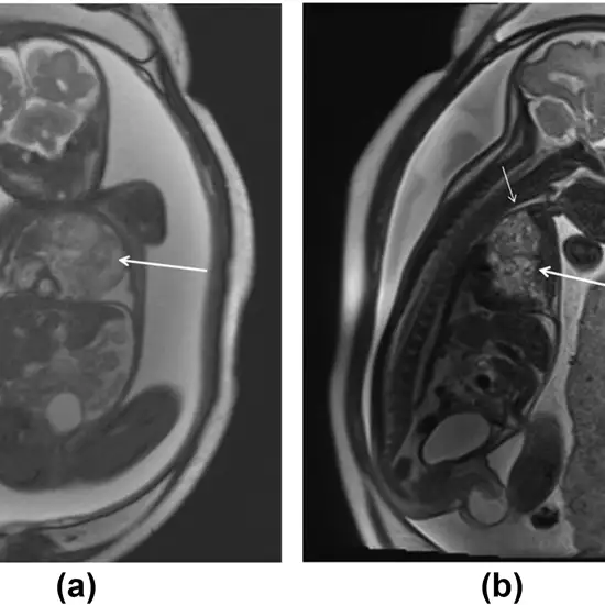 Book Fetal MRI Scan | Test Price In Delhi | Ganesh Diagnostic
