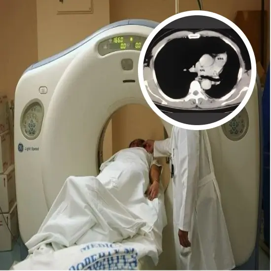 HRCT Thorax Scan | Test Price in Delhi | Ganesh Diagnostics