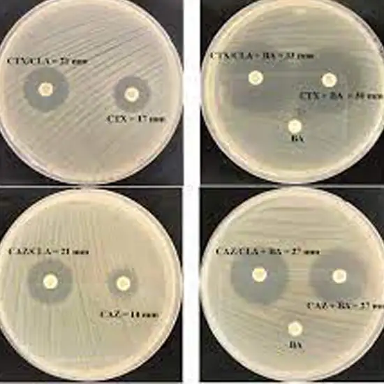 Book Culture ESBL Extended Spectrum Beta-Lactamase | Test Price In ...