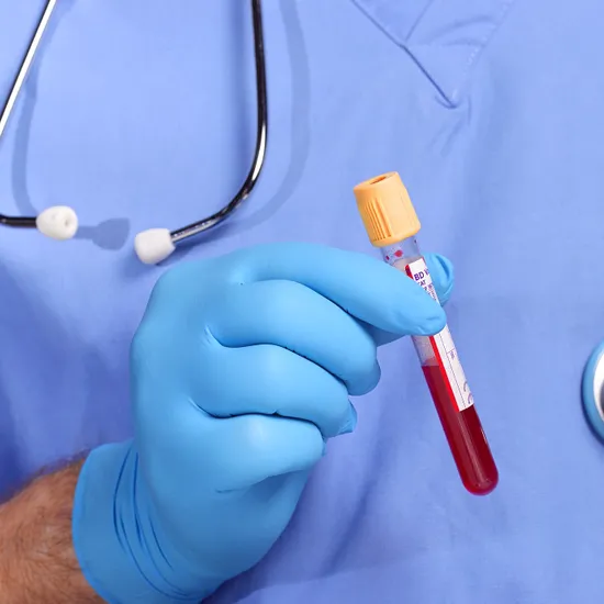 Blood Urea Nitrogen (BUN) | Test Price In Delhi | Cost Near Me, India ...