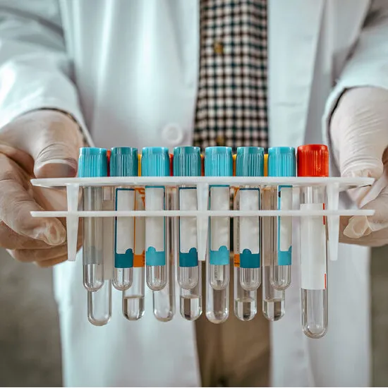 Book Lactate Dehydrogenase (LDH) | Test Price In Delhi | Ganesh Diagnostic