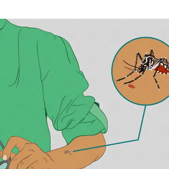 Japanese Encephalitis Virus | Test Price in Delhi | Ganesh Diagnostic