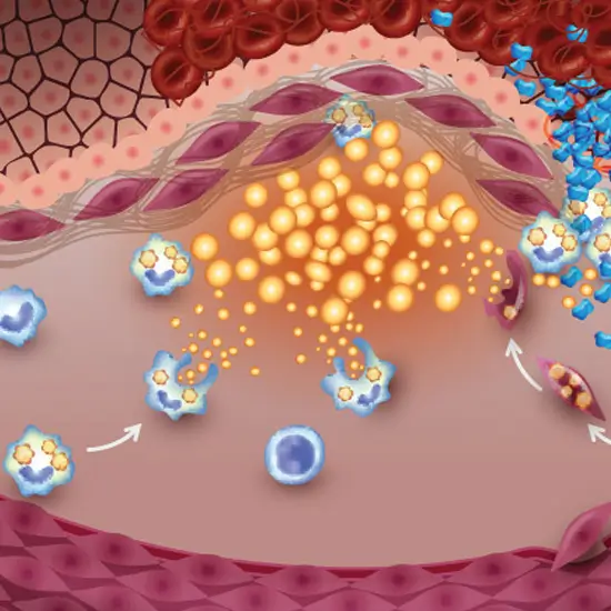Myeloperoxidase (MPO) Test Near You in Delhi | Book Test at Low Price