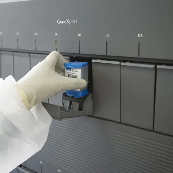 Book Genexpert | Test Price In Delhi | Cost Near Me, India | Ganesh ...