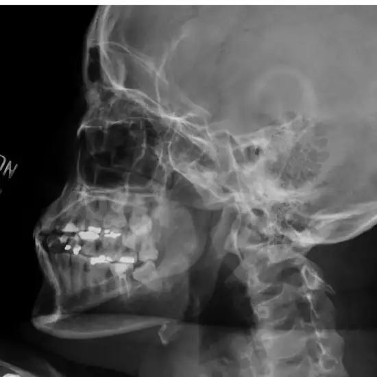 X-Ray TM Joints Right | Test Price in Delhi | Ganesh Diagnostic