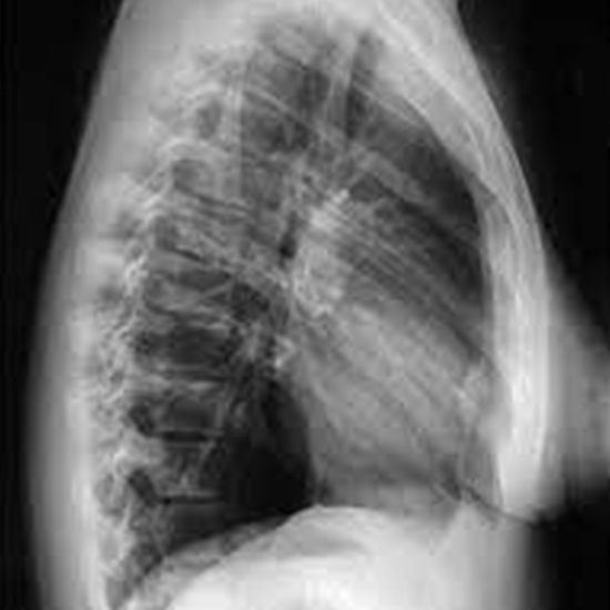 X-ray Sternum Lateral View | Test Price in Delhi | Ganesh Diagnostic