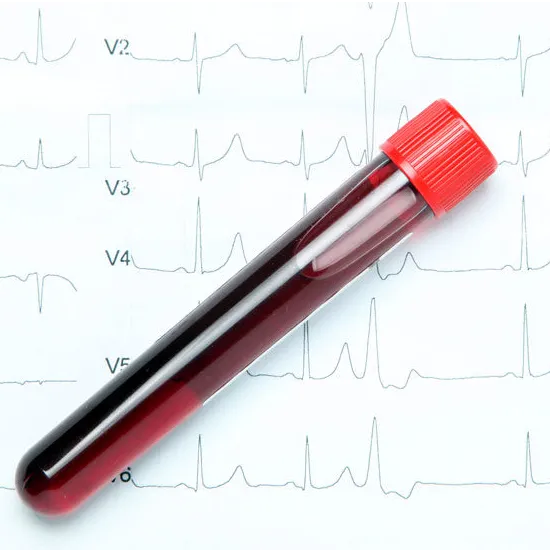 Leukocyte Alkaline Phosphatase Score | Test Cost In Delhi, India ...