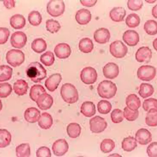 Pyruvate Kinase Test Near You in Delhi | Book Test at Low Price