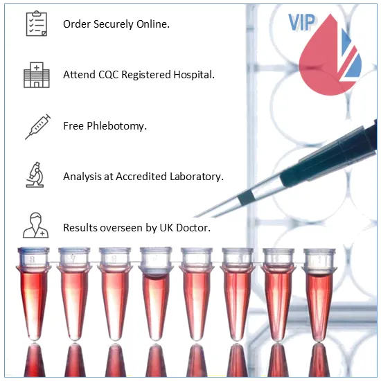 Extractable Nuclear Antigen Antibodies (ENA) Panel Cost in Delhi Test ...
