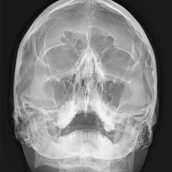 X-ray Right Orbit | Test Price in Delhi | Ganesh Diagnostic