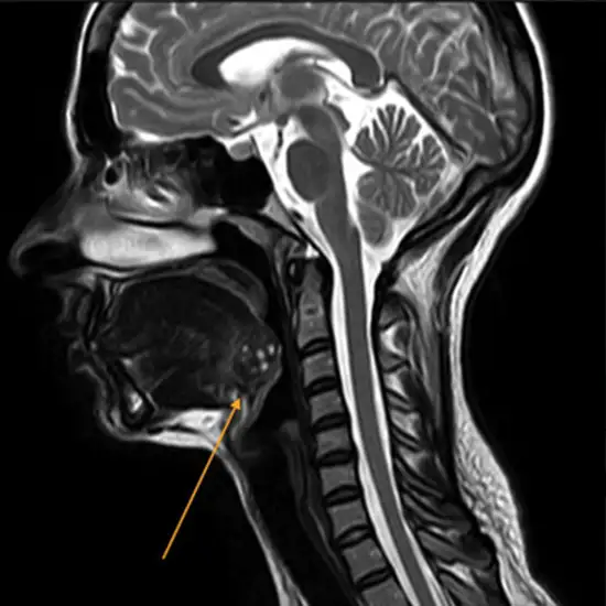 MRI Neck Plain Test Near You in Delhi | Book Test at Low Price