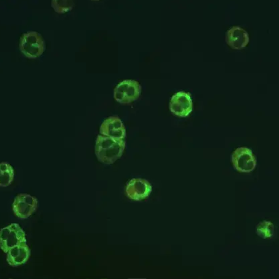 Antineutrophil Cytoplasmic Antibodies ANCA Cost in Delhi Test Price ...