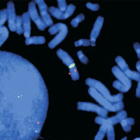 Fluorescent In Situ Hybridization Fish Assay Youtube Fluorescent In