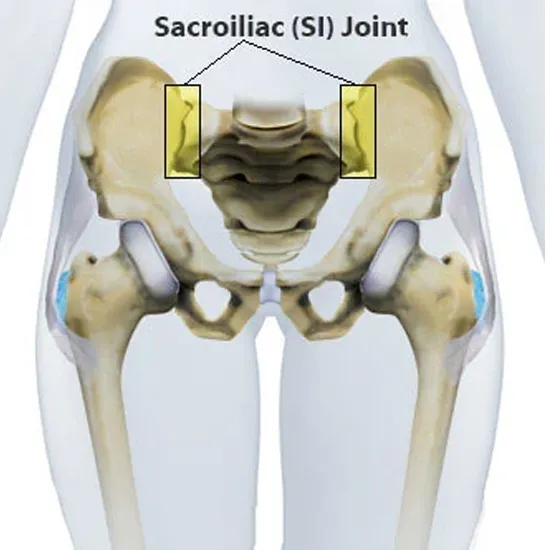MRI Sacroiliac Joint | Test Price In Delhi | Cost Near Me, India ...