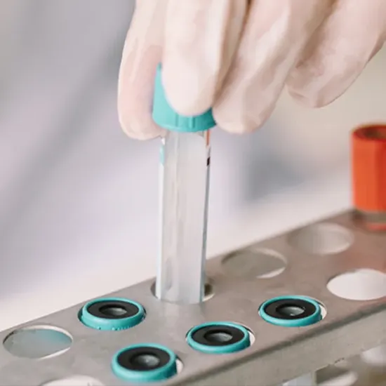 Pregnancy Associated Plasma Protein-A (PAPP-A) | Test Price In Delhi ...