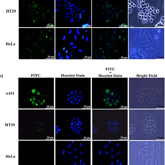 5 Fluorouracil (5 FU) | Book Test at Affordable Cost