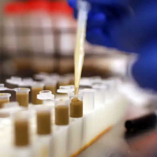 Stool Hanging Drop Test Near You in Delhi | Book Test at Low Price