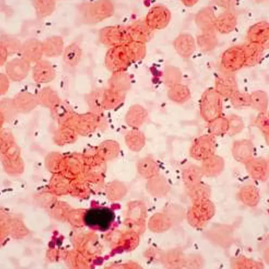 Sputum Culture and Sensitivity (Aerobic) | Test Price in Delhi | Ganesh ...