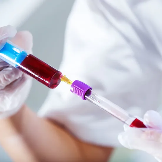 Adrenocorticotropic Hormone (ACTH) | Test Price In Delhi | Cost Near Me ...