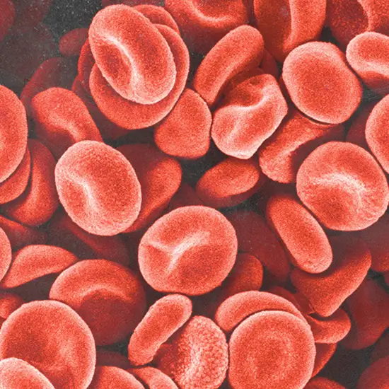 Factor XIII (Clot Solubility) Functional | Test Price In Delhi, India ...