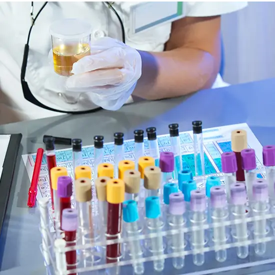 Book Urinary Sodium | Test Price In Delhi | Ganesh Diagnostic