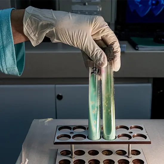 Sputum Culture & Sensitivity | Test Price In Delhi, India | Ganesh ...