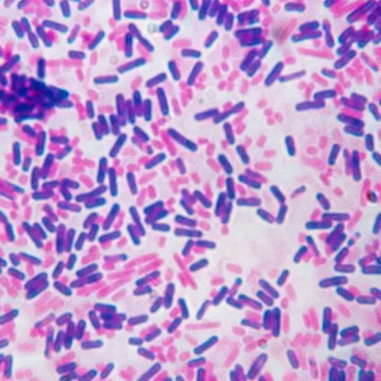 Gram Stain | Test Price In Delhi | Cost Near Me, India | Ganesh Diagnostic