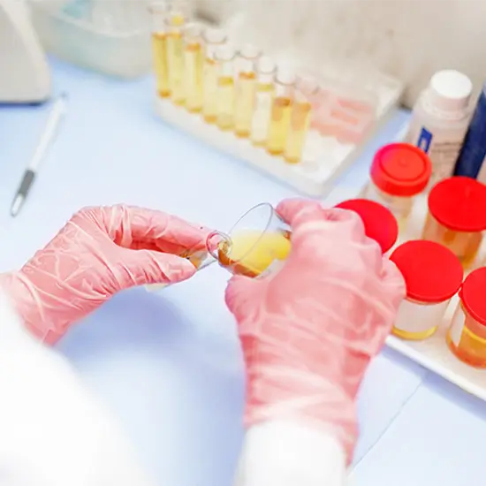 Selenium, 24 Hour Urine | Test Price In Delhi | Cost Near Me, India ...