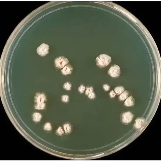 Nocardia Culture | Test Price in Delhi | Ganesh Diagnostic