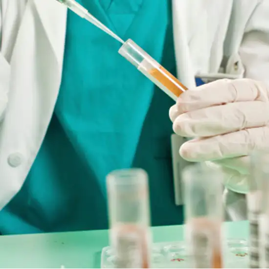 Book Urine For Chyle | Test Price In Delhi | Ganesh Diagnostic