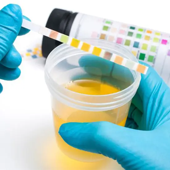 Book Urine Potassium | Test Price In Delhi | Cost Near Me, India ...