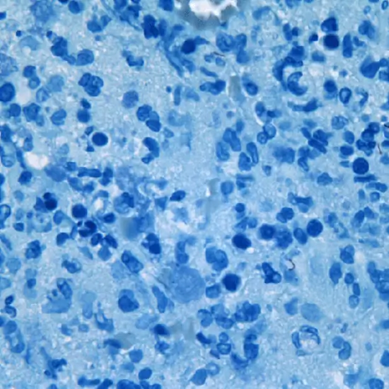 PCR For Acid-Fast Bacillus (AFB) Test Near You in Delhi | Book Test at ...