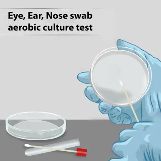 Culture Aerobic (Automated)- Ocular Fluid | Test Price In Delhi, India ...