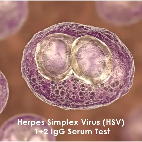 Herpes Simplex Virus 1+2 IgG Serum Cost in Delhi Test Price Near Me ...