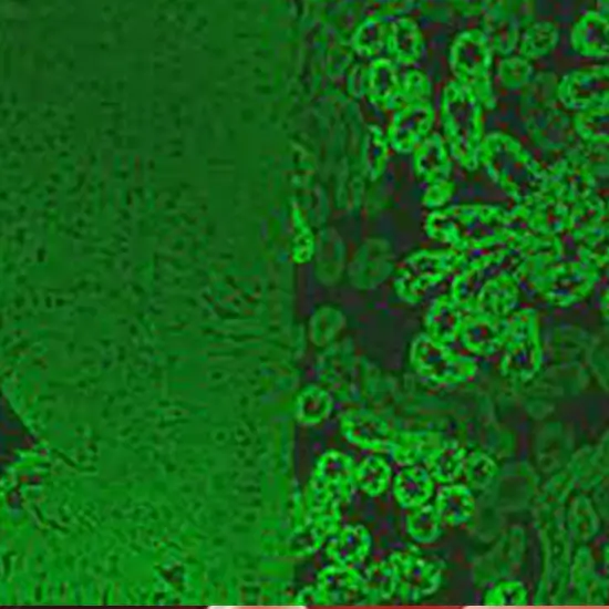 Liver Kidney Microsomal Antibody Dilutions IFA | Test Price In Delhi ...