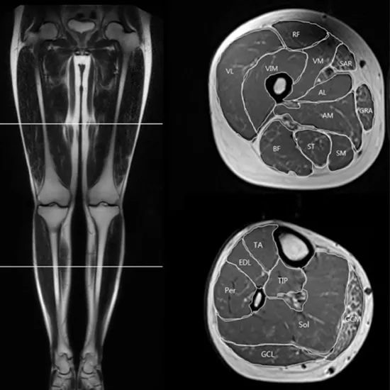 MRI Lower Limb | Test Price in Delhi | Ganesh Diagnostic